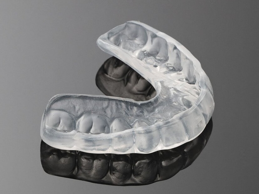 Custom Mouth Guard Don t Risk Losing Your Great Smile Custom Mouth Guard Don t Risk Losing Your Great Smile